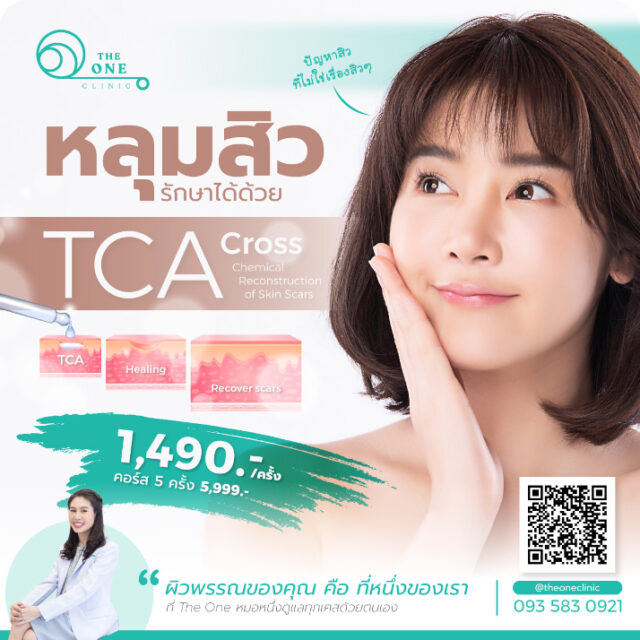 บริการหัตถการความงาม บริการด้านความงาม | The One Clinic