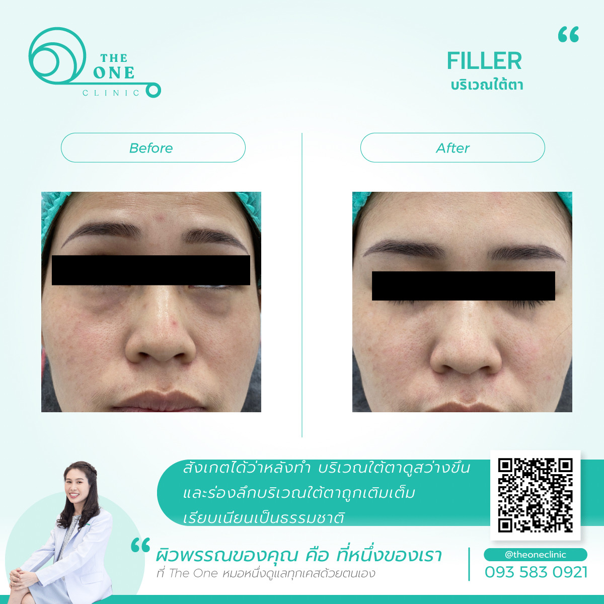 บริการหัตถการความงาม บริการด้านความงาม | The One Clinic