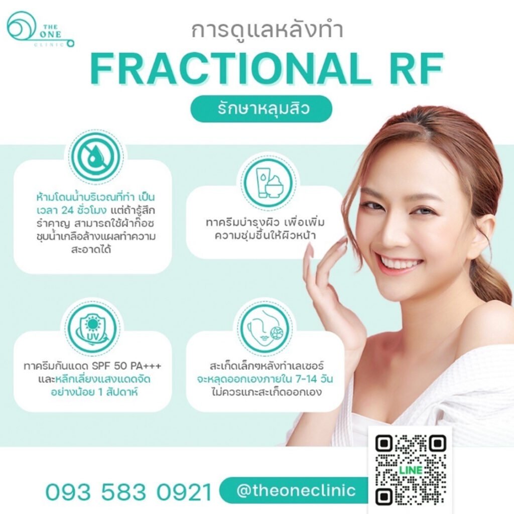 คอร์สรักษาหลุมสิว Fractional RF