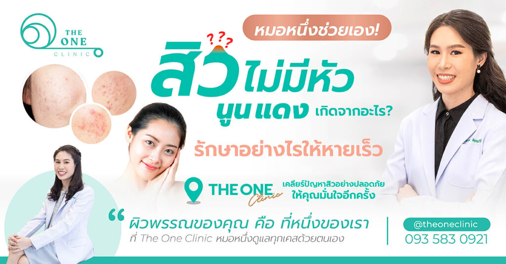 คลินิกรักษาสิวและโรคผิวหนัง โดยแพทย์เฉพาะทาง | The One Clinic