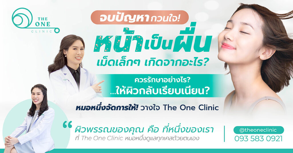 จบปัญหากวนใจ! หน้าเป็นผื่นเม็ดเล็กๆ เกิดจากอะไร? รักษาอย่างไรให้ผิวกลับเรียบเนียน? - The One Clinic